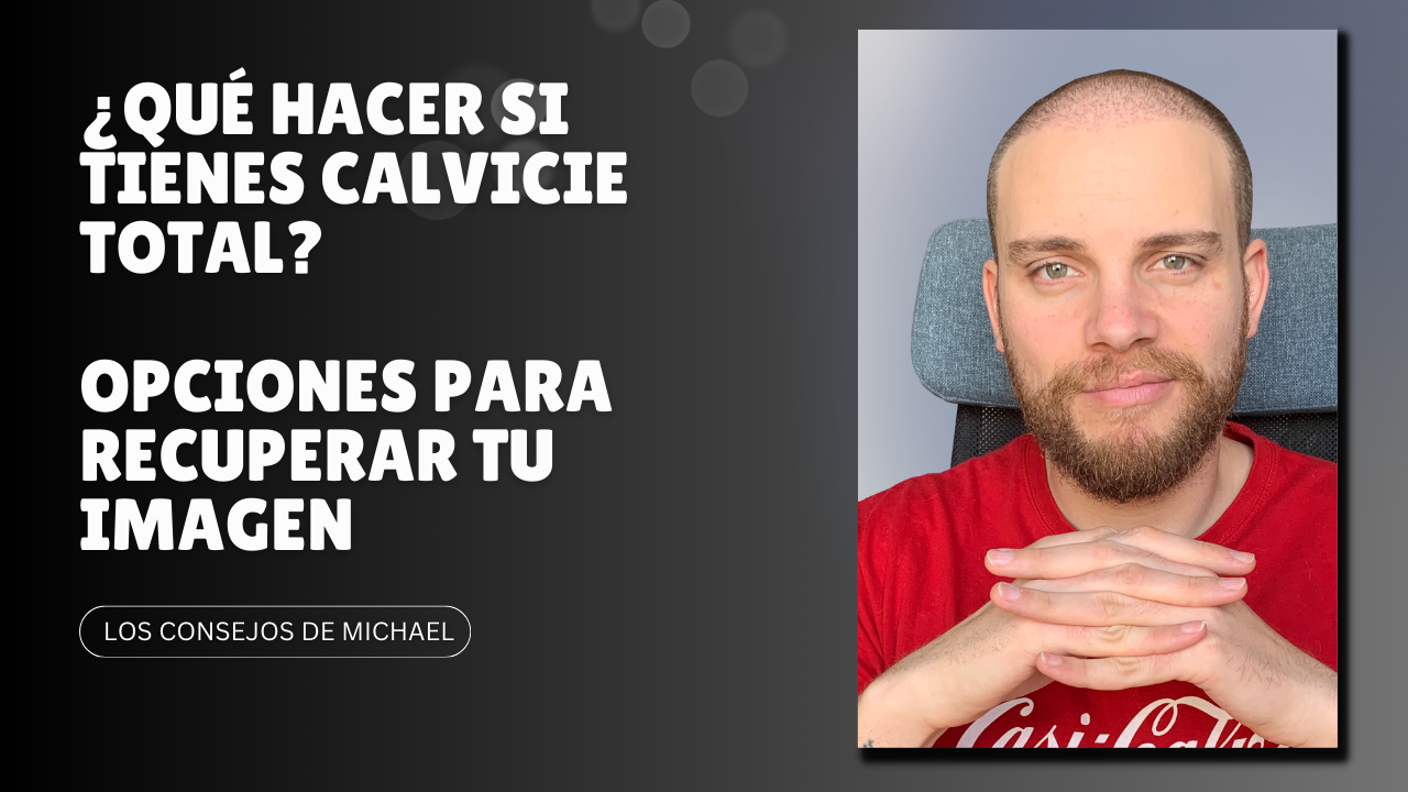 ¿Qué hacer si tienes calvicie total? Guía práctica para abordar la alo ...